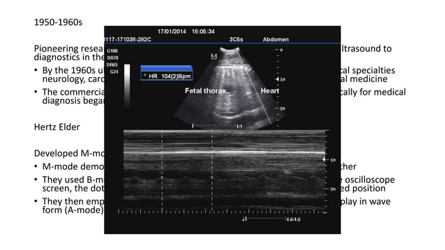Basics of Ultrasound.pptx | Science