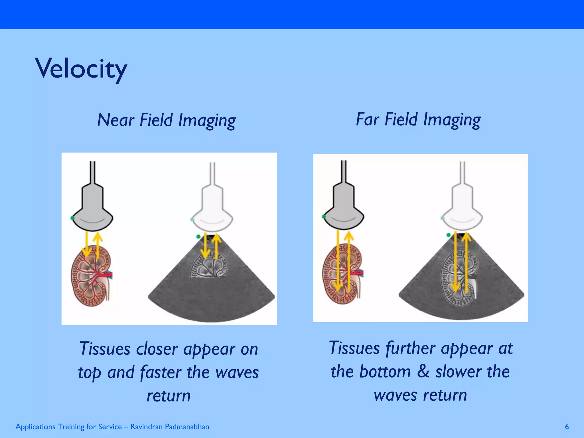 Basics Physics of ultrasound | PPT