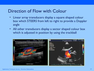 Basics Physics of ultrasound | PPT