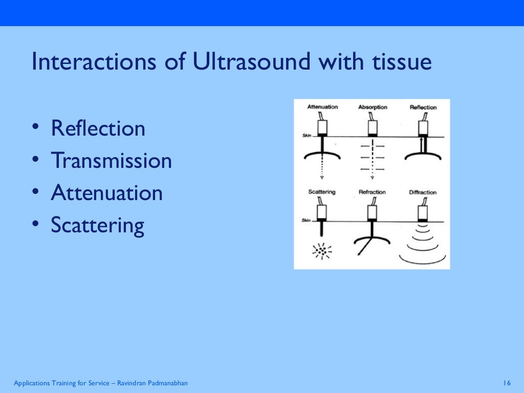 Basics Physics of ultrasound