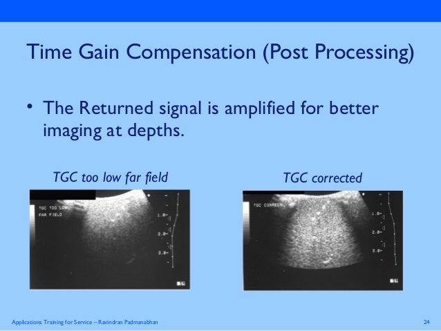 Basics Physics of ultrasound