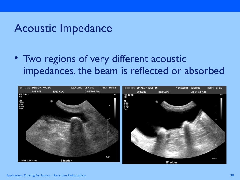 Basics Physics of ultrasound