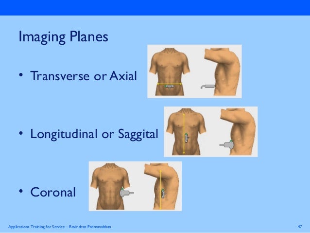 Basics Physics of ultrasound