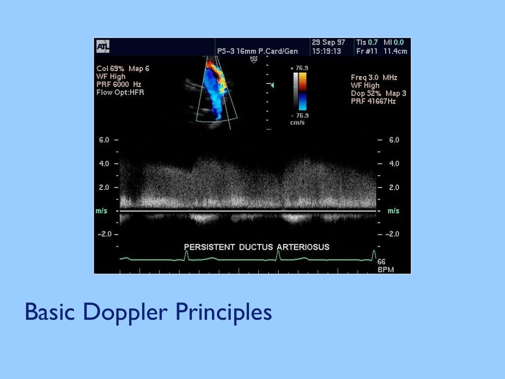 Basics Physics of ultrasound