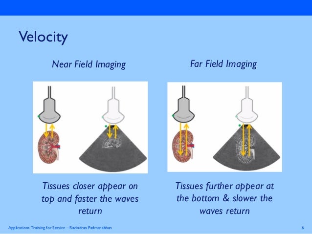 Basics Physics of ultrasound