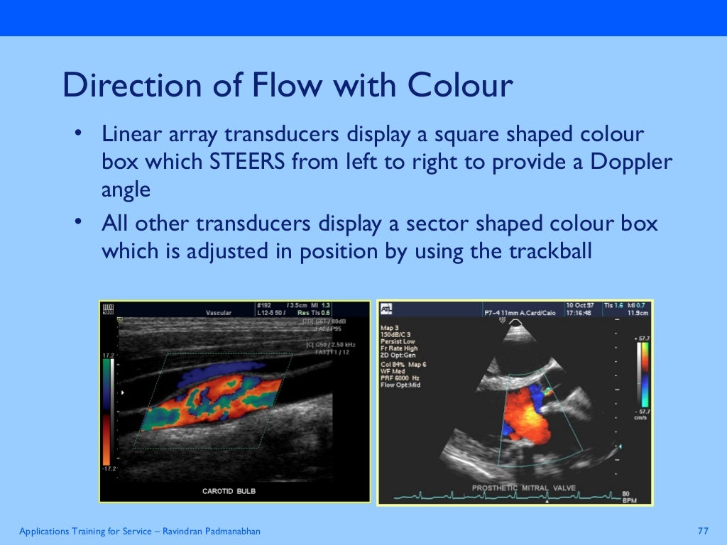 Basics Physics of ultrasound