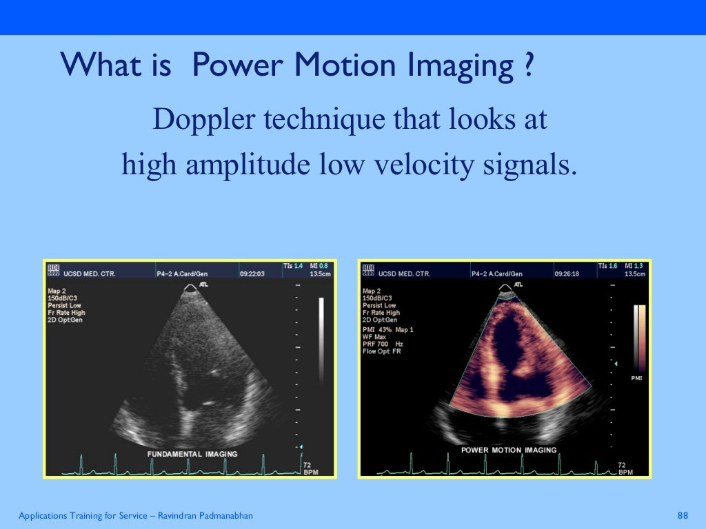 Basics Physics of ultrasound