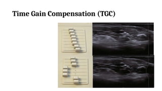 Basics of Ultrasound for anesthesiologist .pptx