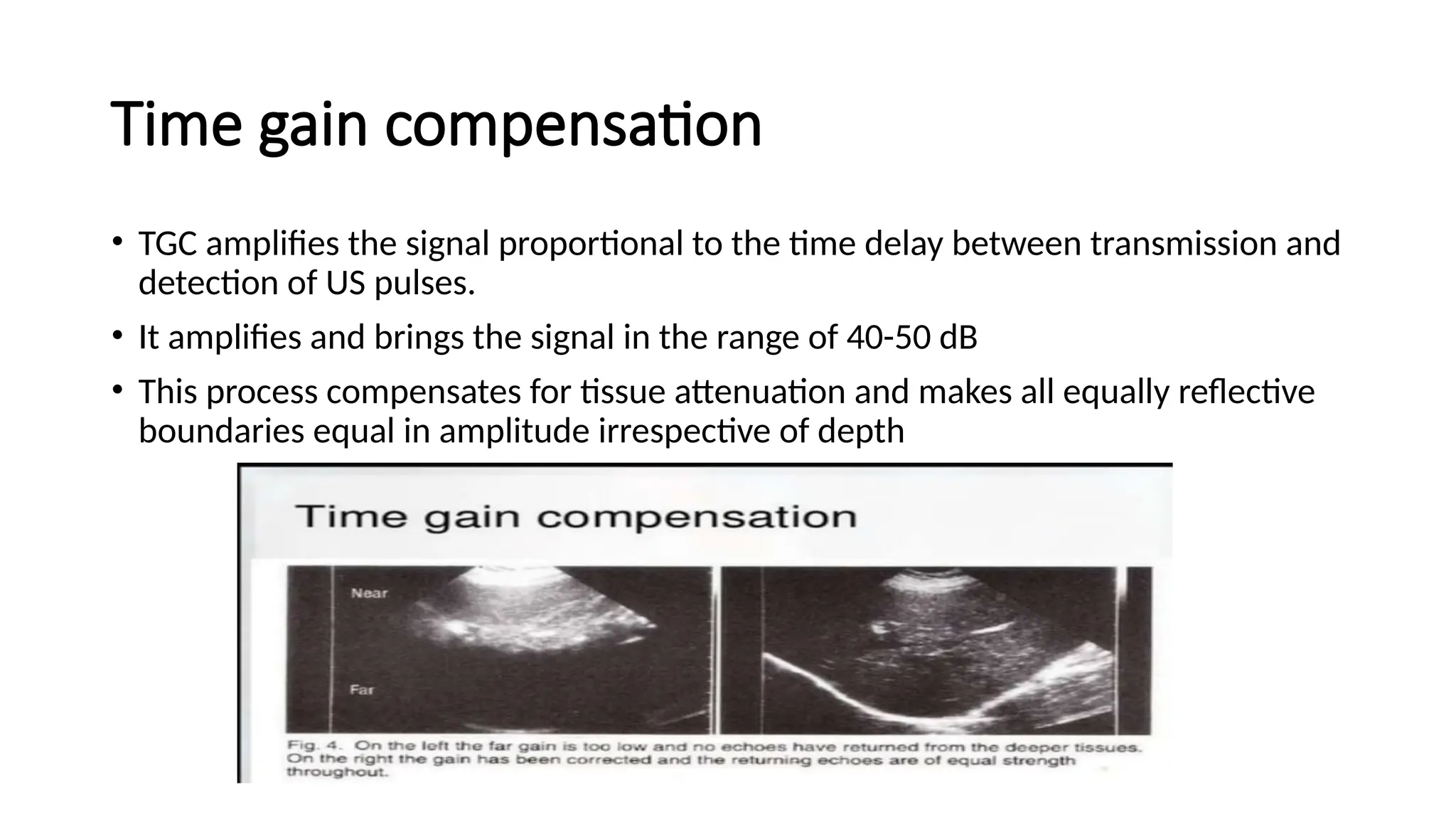 BASICS OF ULTRASOUND PG RADIOLOGY.pptx FOR RADIOLOGG 1ST YEARP | PPTX