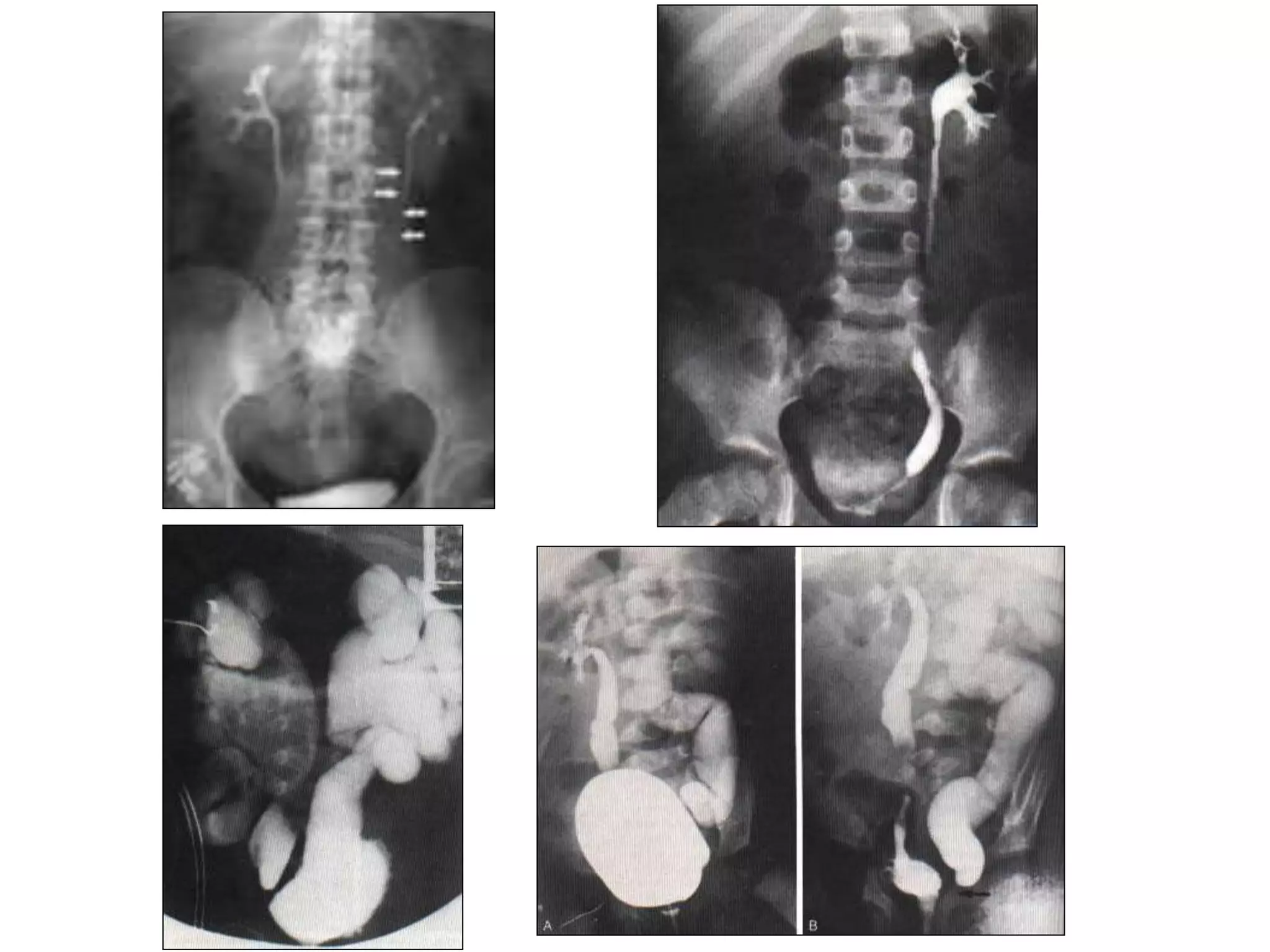 Basics of urology 1.pptx