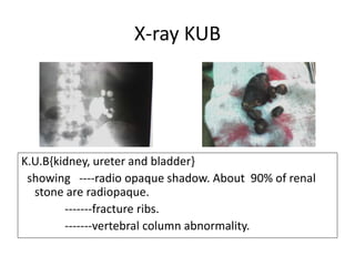 Basics of urology 1.pptx | Foot Health | Diseases and Conditions