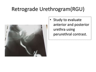Basics of urology 1.pptx | Foot Health | Diseases and Conditions