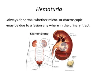 Basics of urology 1.pptx | Foot Health | Diseases and Conditions