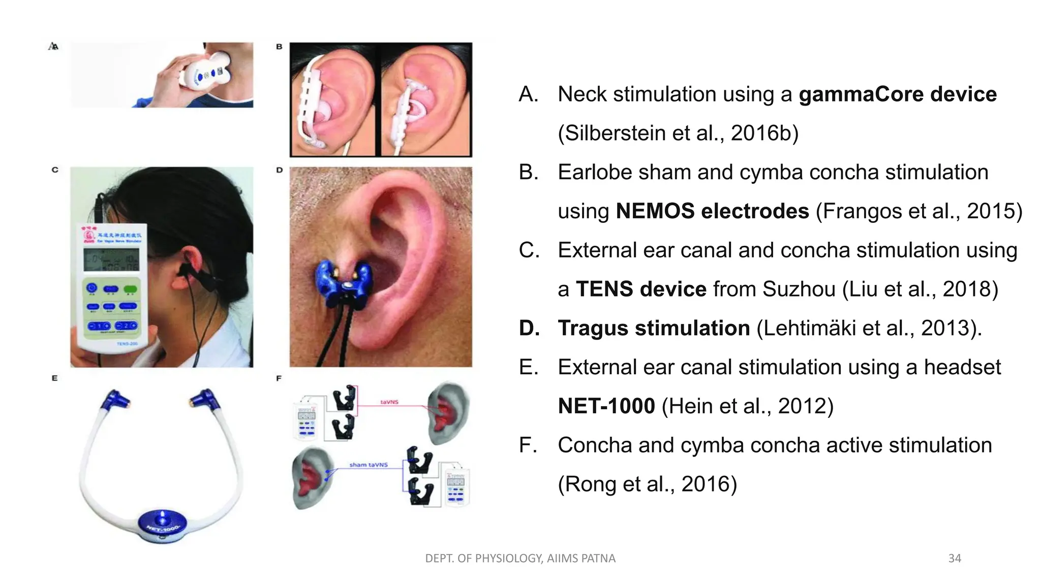 Basics of Vagal Nerve Stimulation (VNS) | PDF