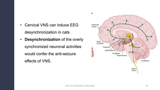 Basics of Vagal Nerve Stimulation (VNS) | PDF