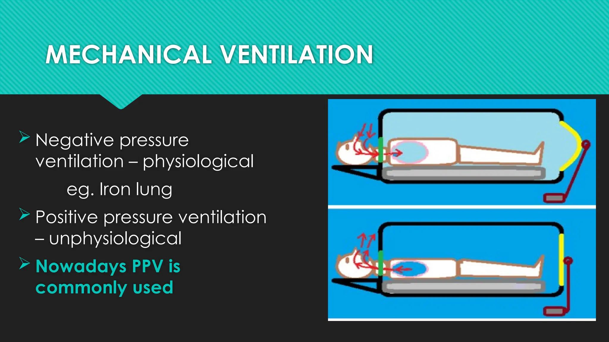 Basics of ventilation in children 18.9.24.pptx