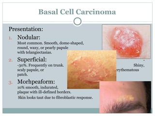 Basics of wounds, lumps, bumps, and rashes for gwep 2018 | PPTX