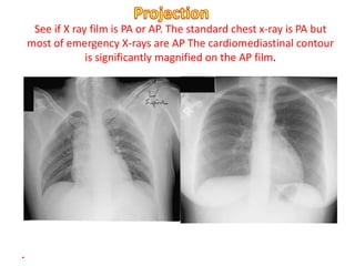 Presentation on basics of X ray , CT and USG-1.pdf