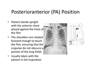 Presentation on basics of X ray , CT and USG-1.pdf