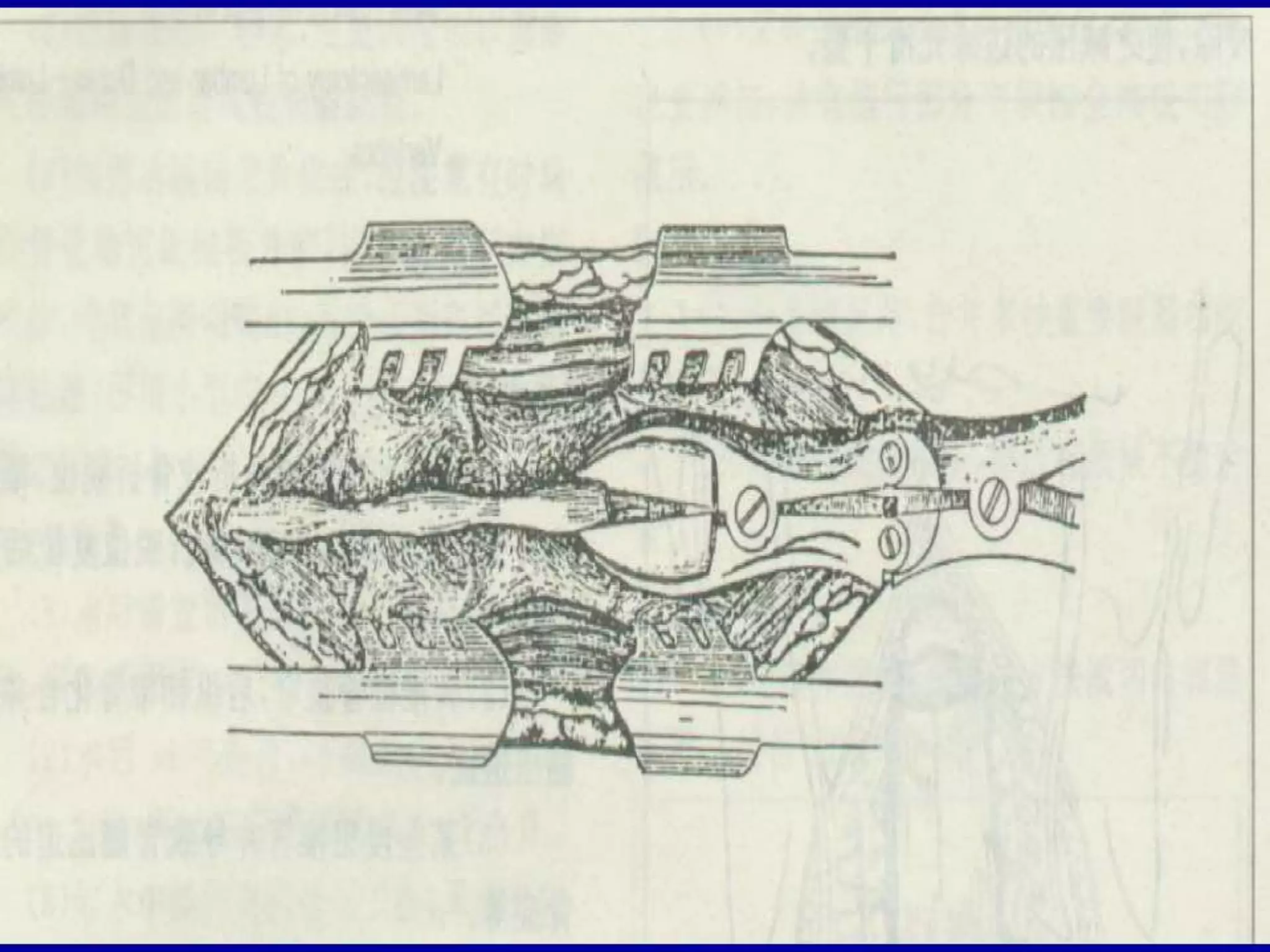 basic spinal instrument.docx