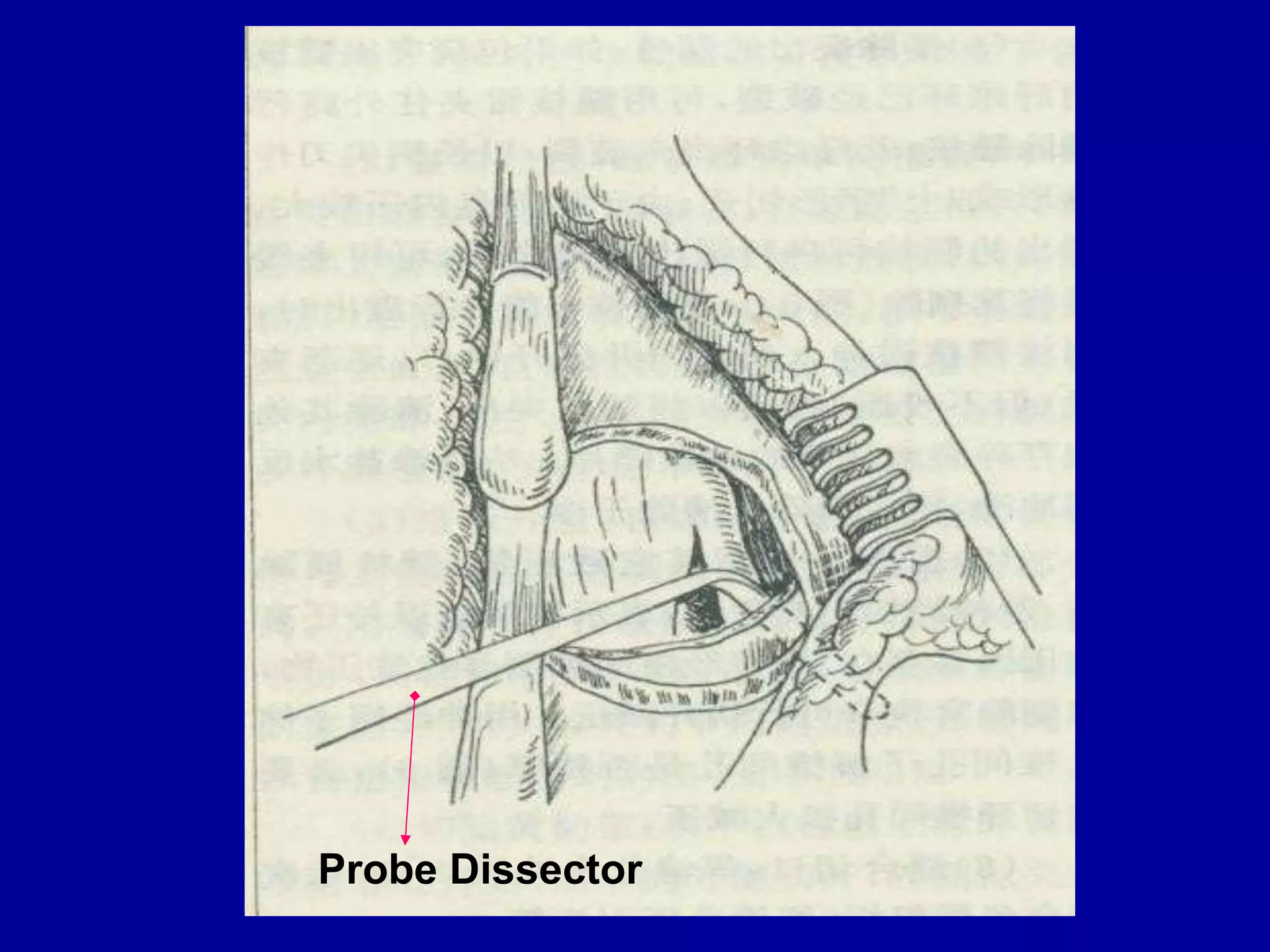 basic spinal instrument.docx