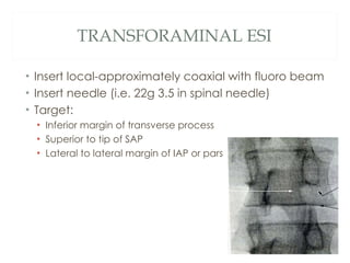 Basic spine injections | PPT