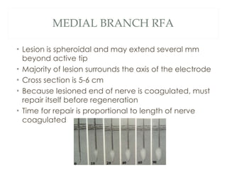 Basic spine injections | PPT
