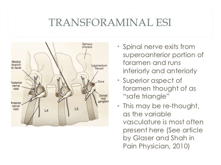 Basic spine injections