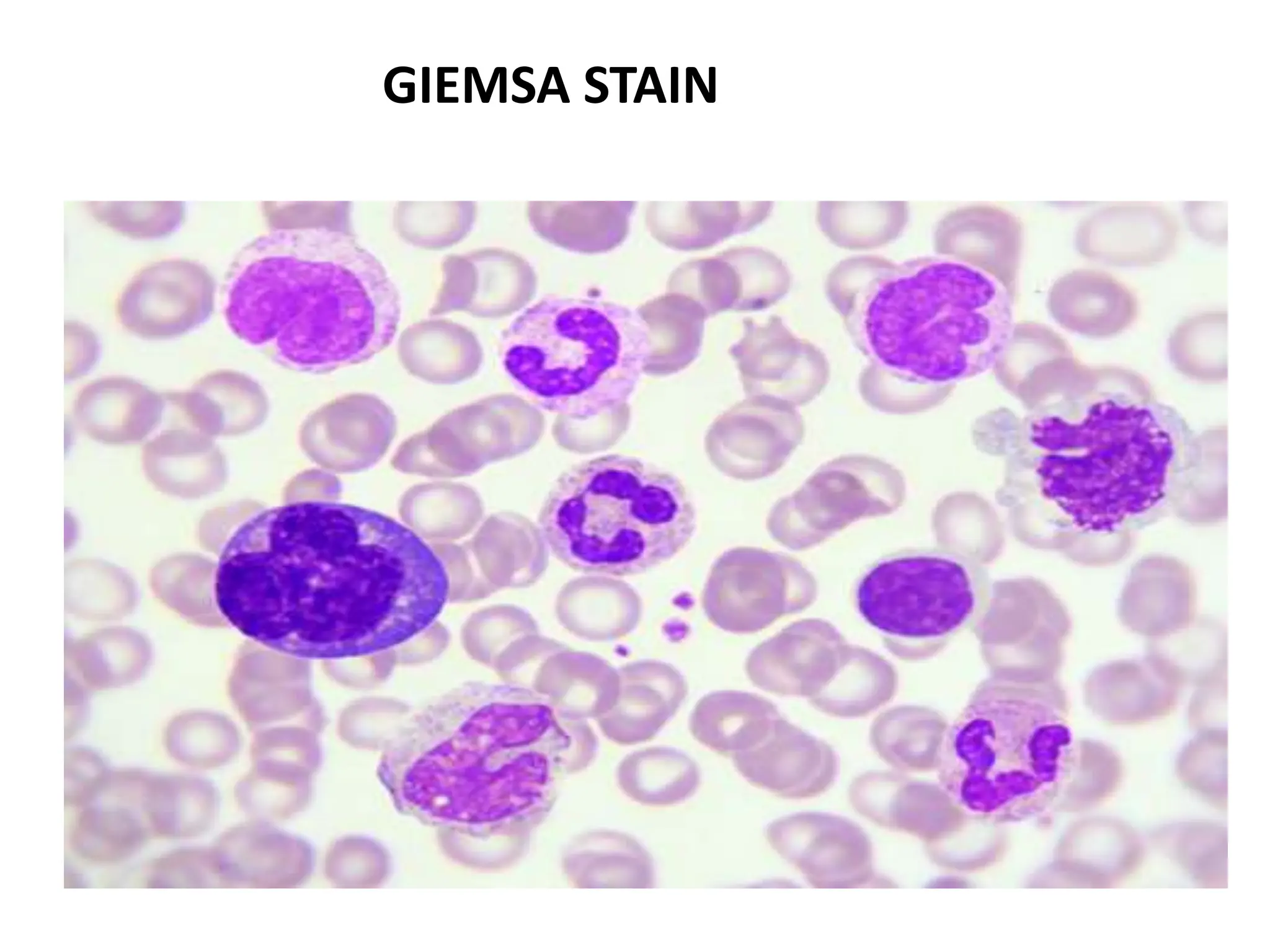 basic staining techniques in hematology.pptx