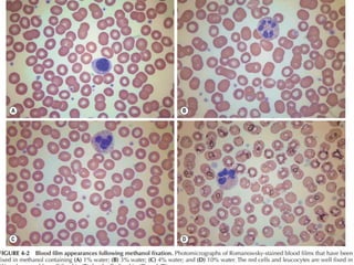basic staining techniques in hematology.pptx