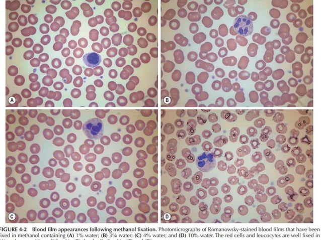 basic staining techniques in hematology.pptx | Blood Disorders ...