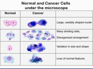 Basic steps in cancer research by Prof. Mohamed Labib Salem, PhD | PDF