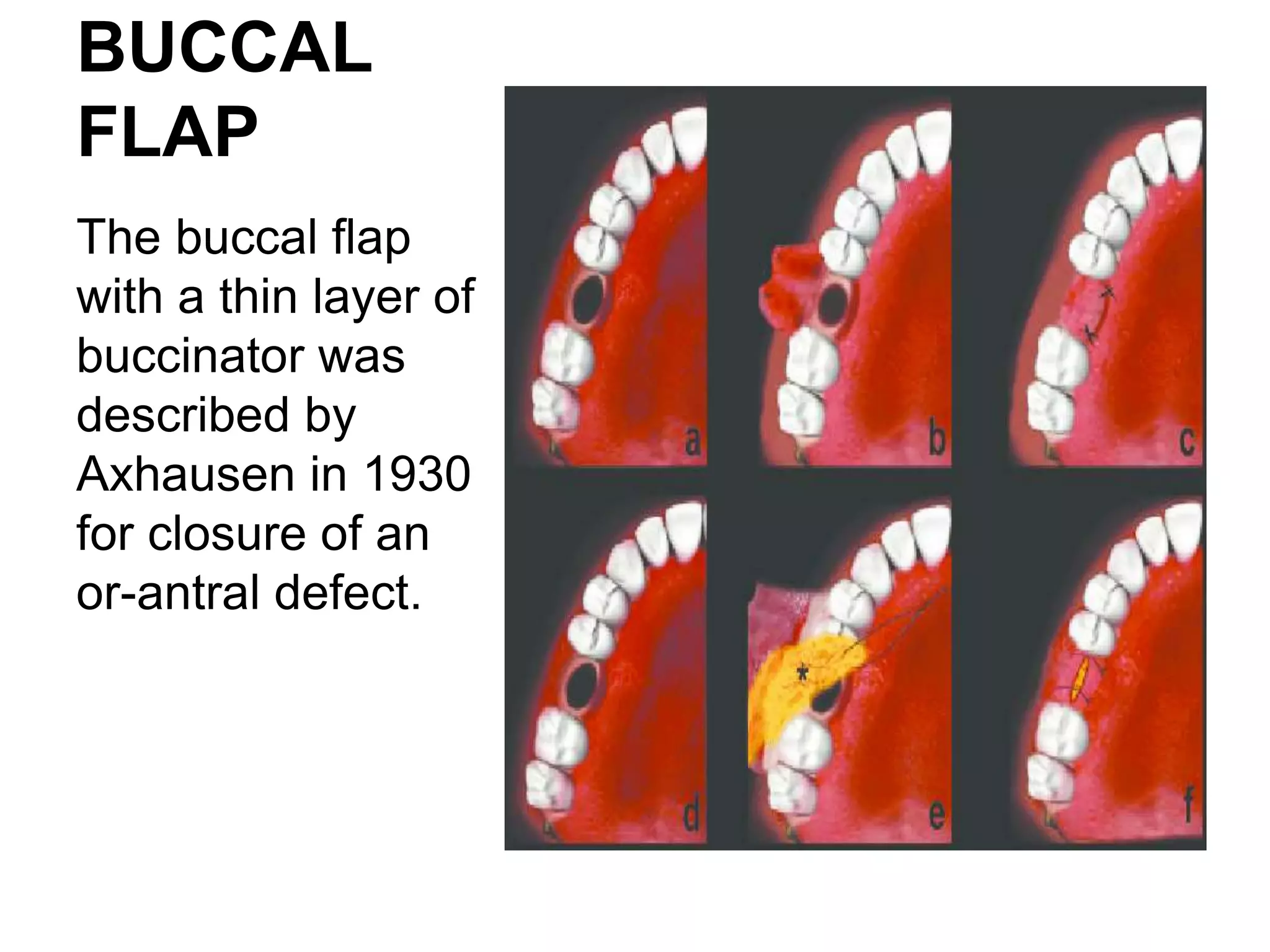 Basic surgical procedures | PPT