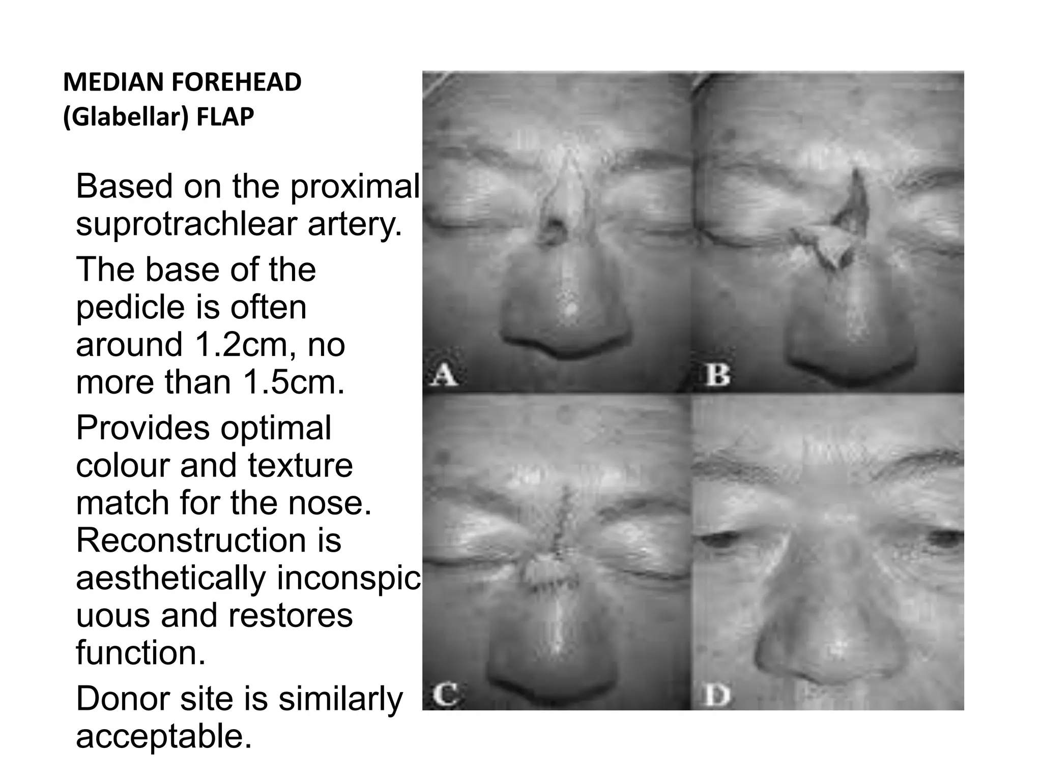 Basic surgical procedures | PPT