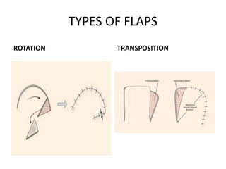 Basic surgical procedures | PPT