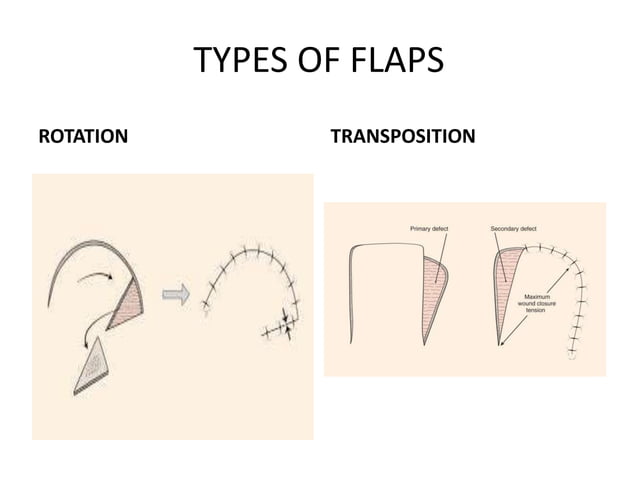 Basic surgical procedures | PPT