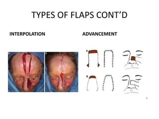 Basic surgical procedures | PPT
