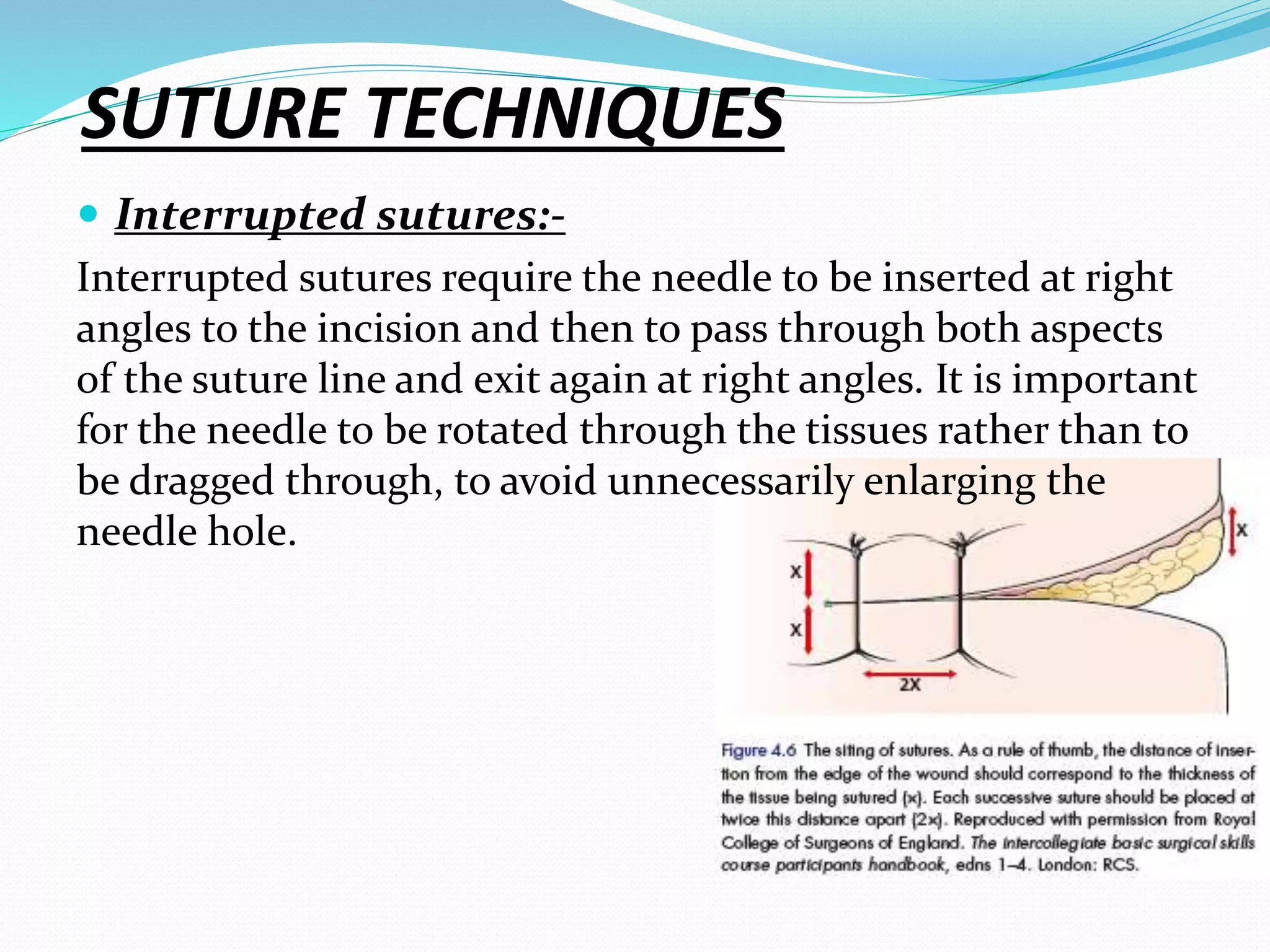 Basic surgical skill and anastomoses | PPTX