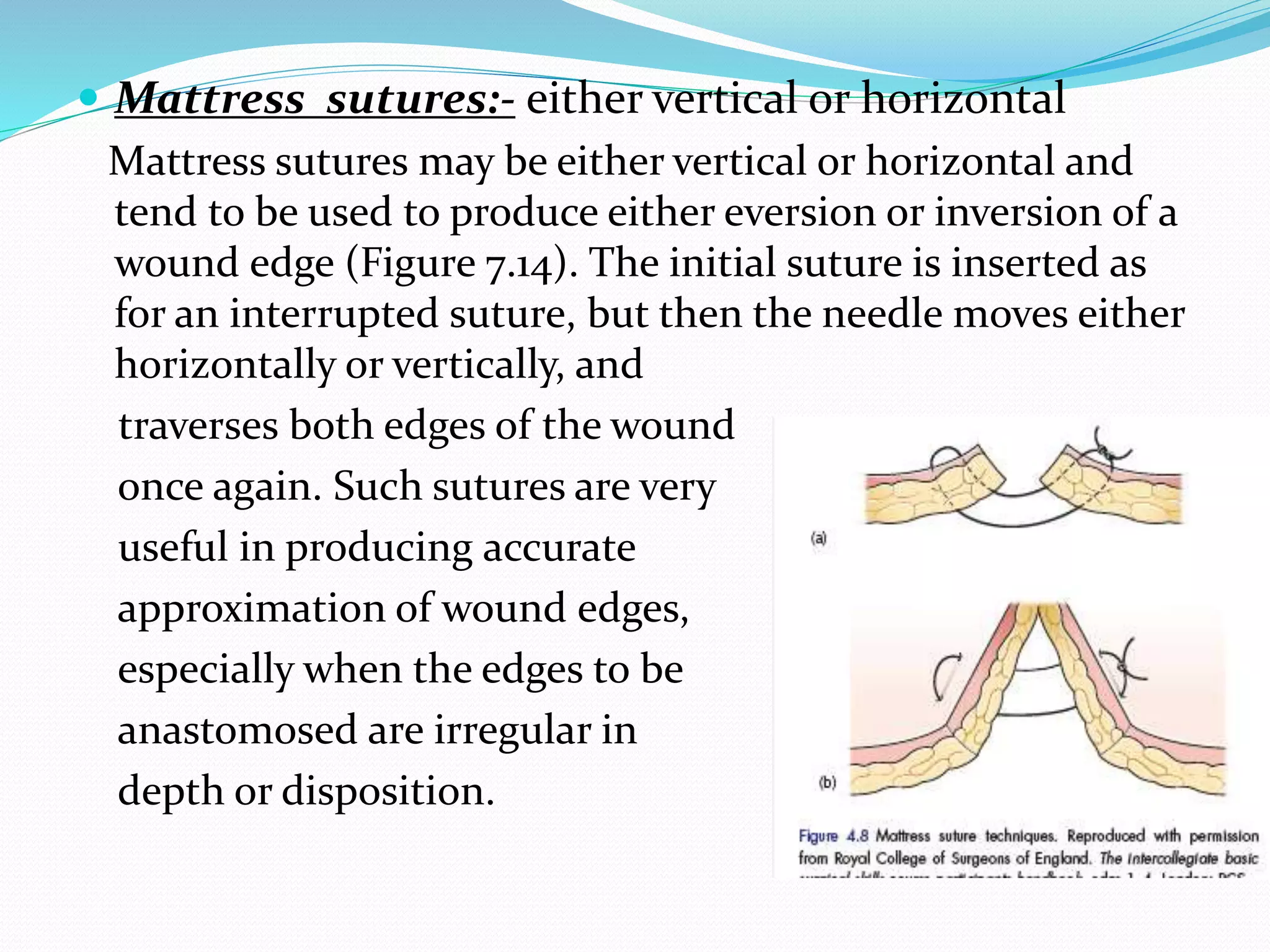 Basic surgical skill and anastomoses | PPTX