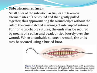 Basic surgical skill and anastomoses | PPTX
