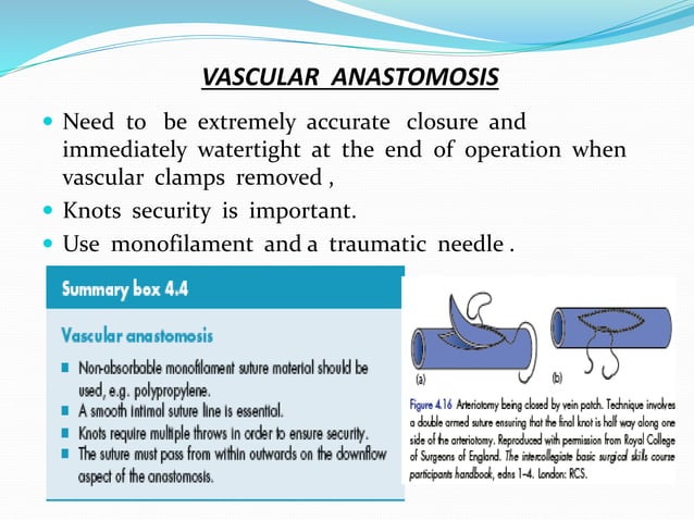 Basic surgical skill and anastomoses | PPTX