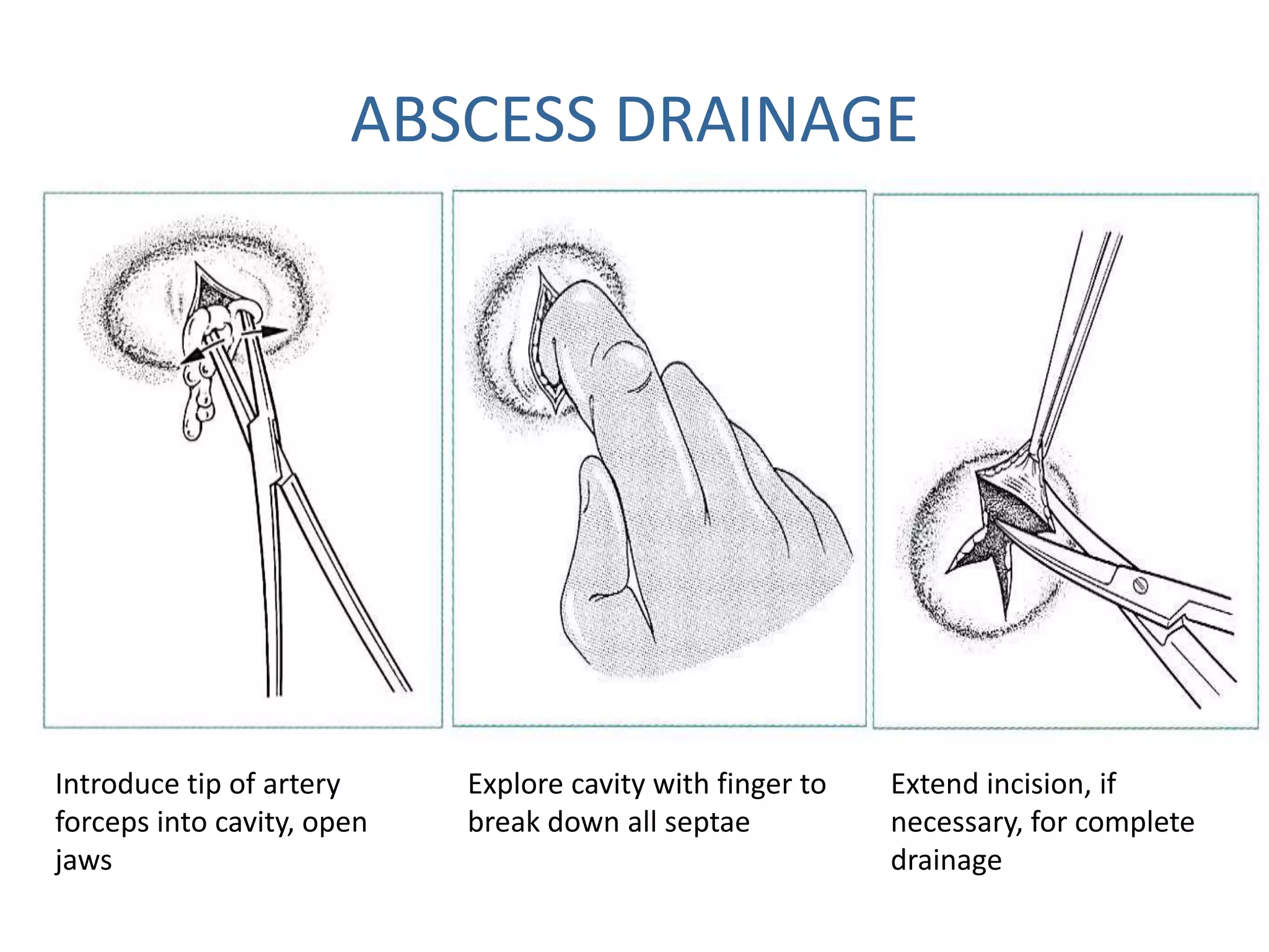 Basic surgical skills | PPTX