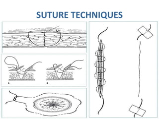 Basic surgical skills | PPTX