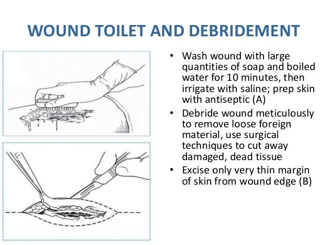 Basic surgical skills