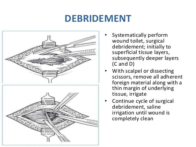 Basic surgical skills