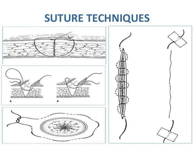 Basic surgical skills