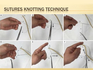 Basic surgical skills | PPTX