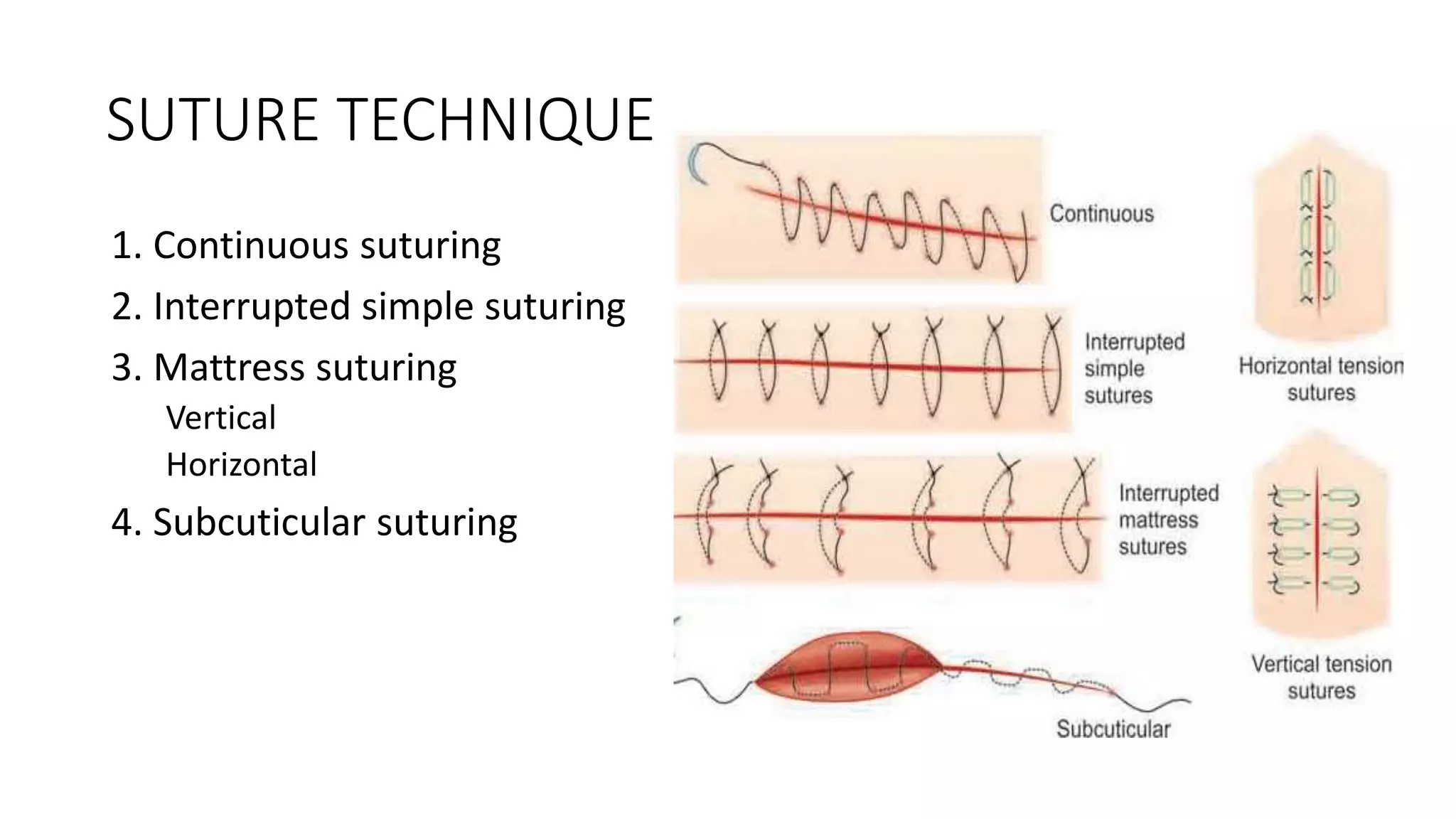 Basic surgical skills | PPTX
