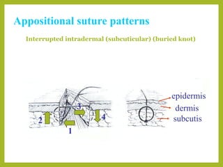 Basic suture patterns | PPT