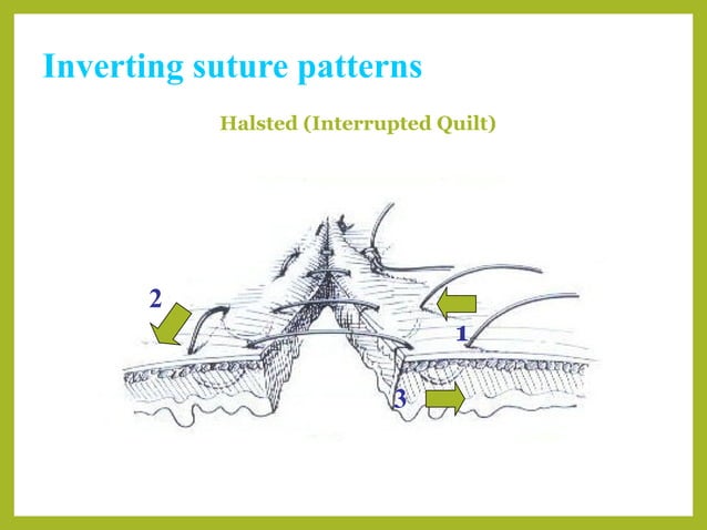 Basic suture patterns | PPT